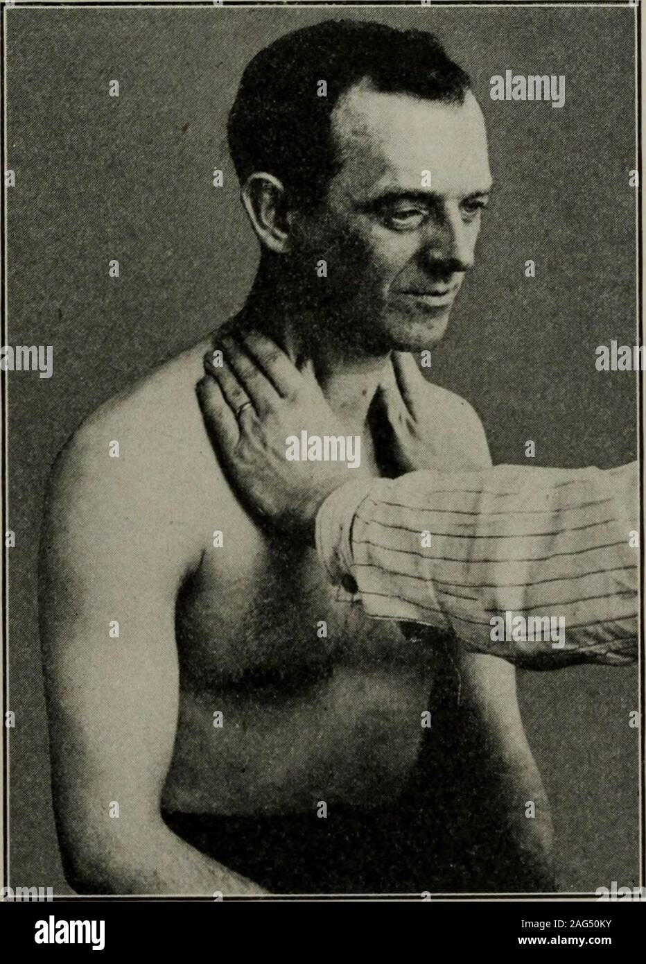 Muscular rigidity hi-res stock photography and images - Alamy