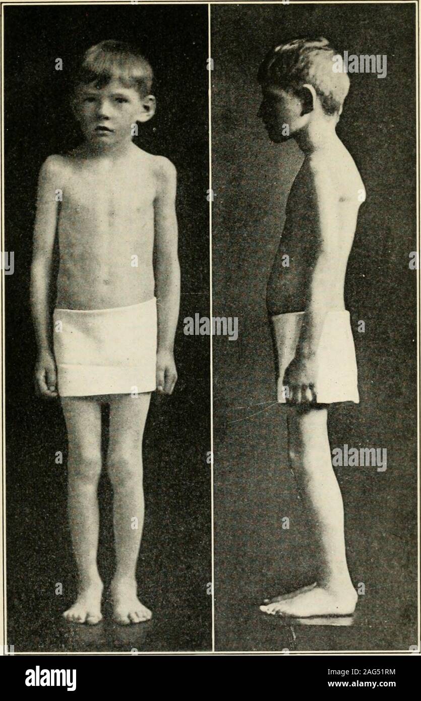 . Nutrition and growth in children. rition.The serious, drawn look with ...