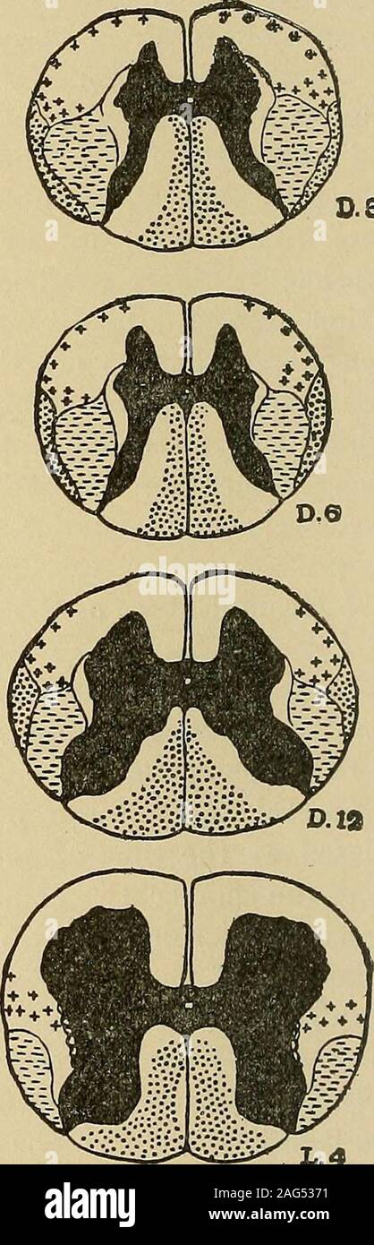 Cauda equina hi-res stock photography and images - Alamy