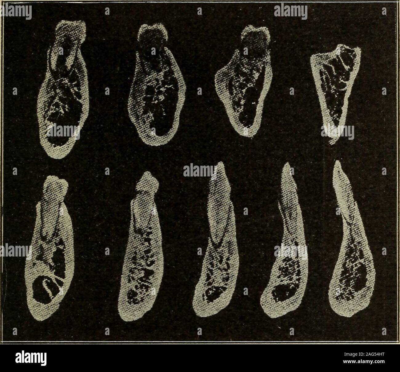 Alveolar process of maxilla hi-res stock photography and images - Alamy