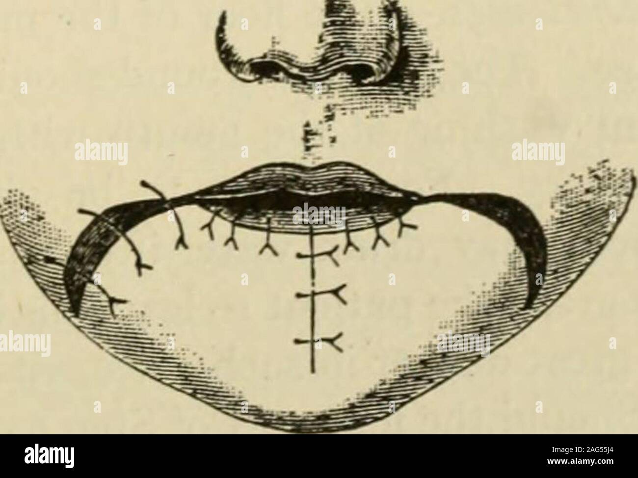 Divided chin hi-res stock photography and images - Alamy
