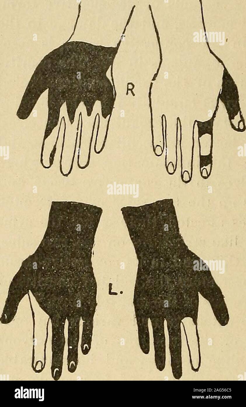 Jerk position hi-res stock photography and images - Alamy