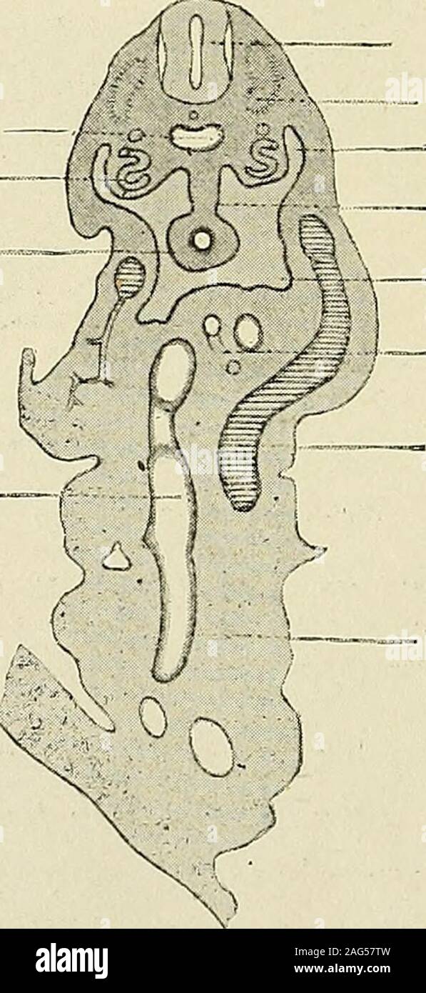 Wolffian duct hi-res stock photography and images - Alamy