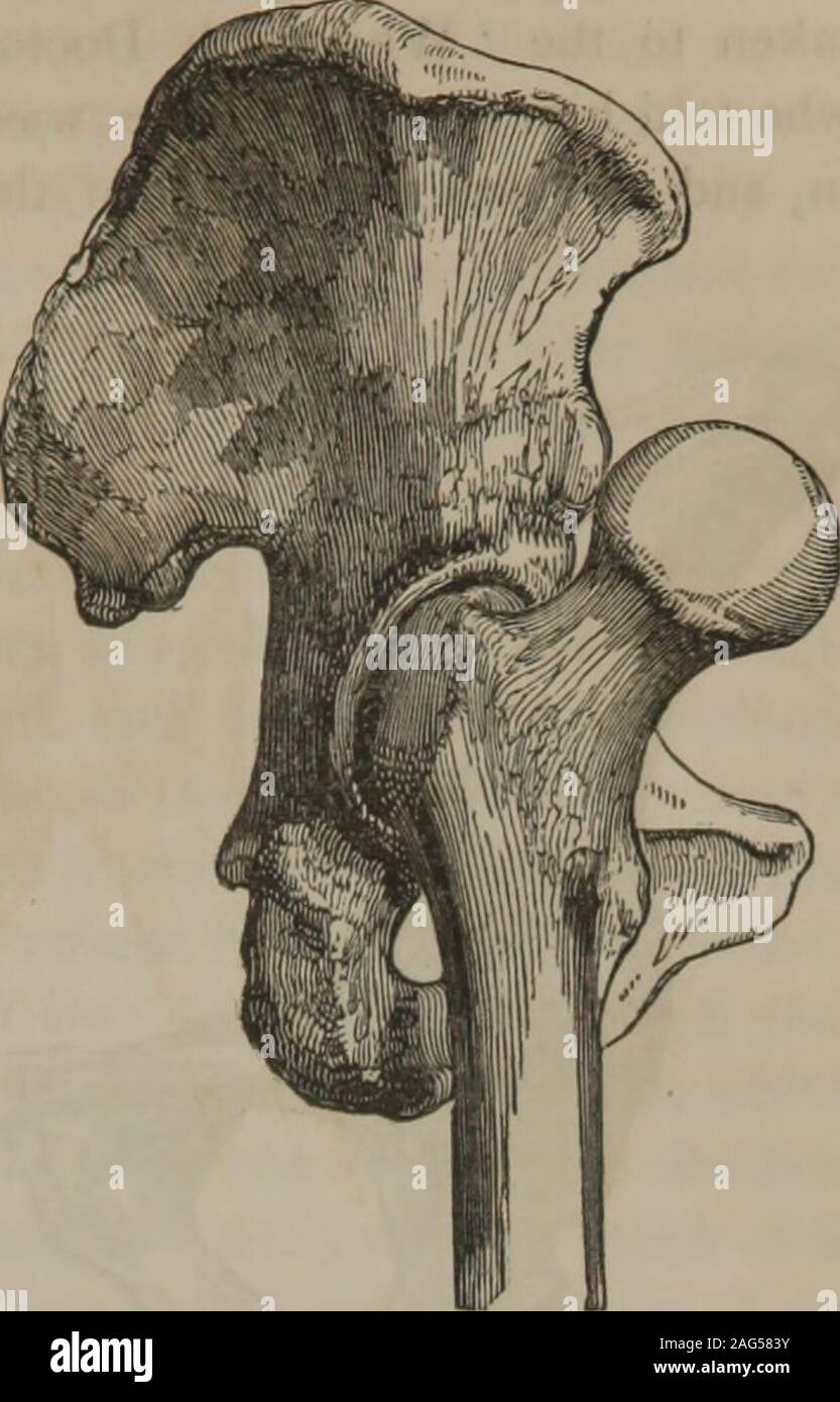 . A treatise on dislocations and fractures of the joints. rbefore his ...