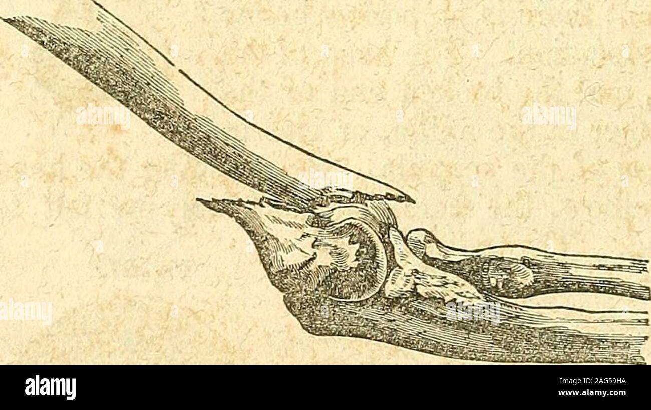 . The principles and practice of modern surgery. ns to children. The ra ...