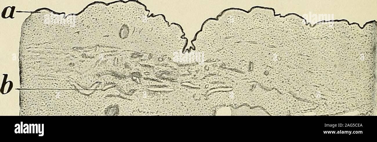 . Gynecological pathology; a manual of microscopic technique and ...