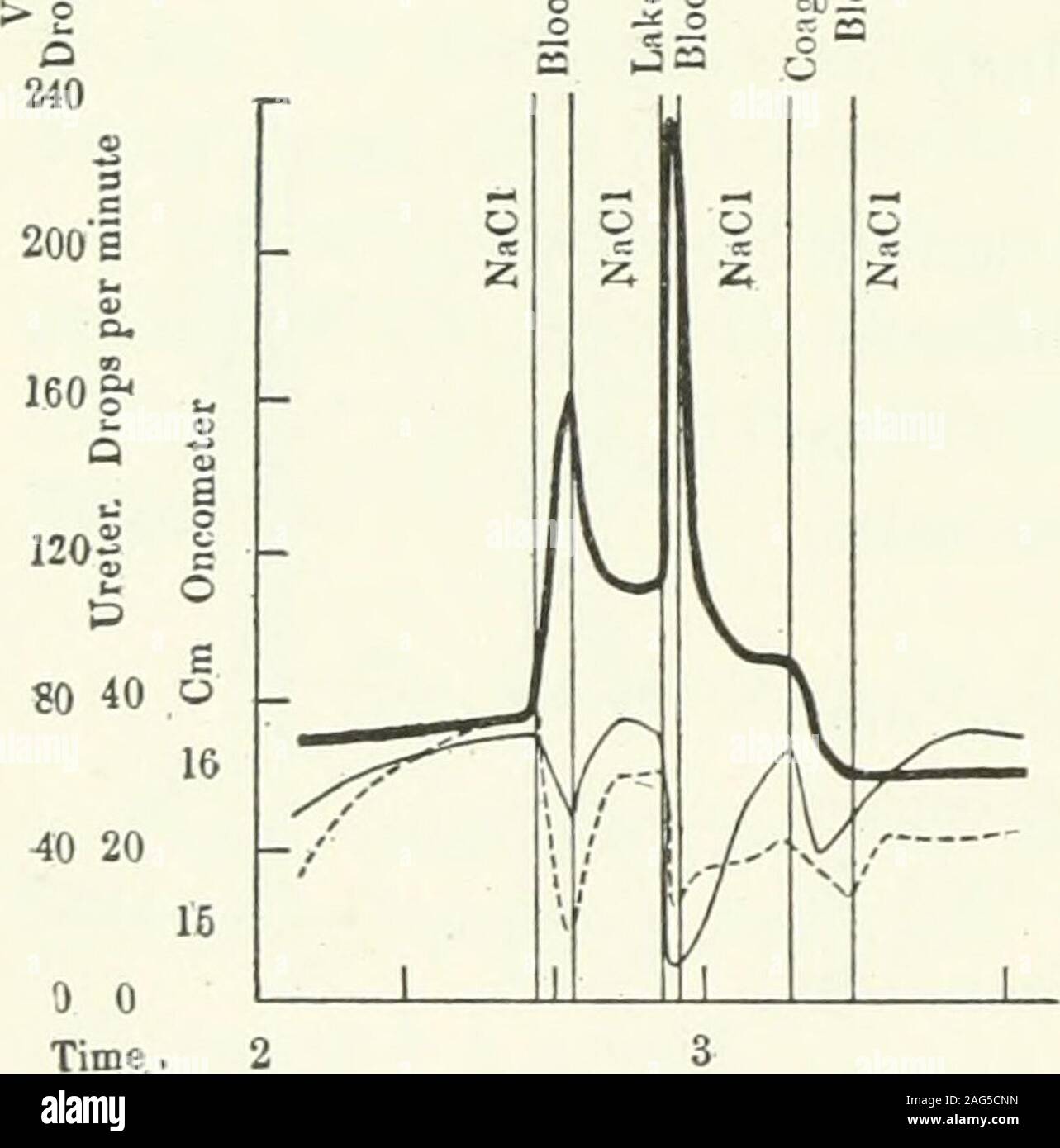Unlikely part hi-res stock photography and images - Alamy