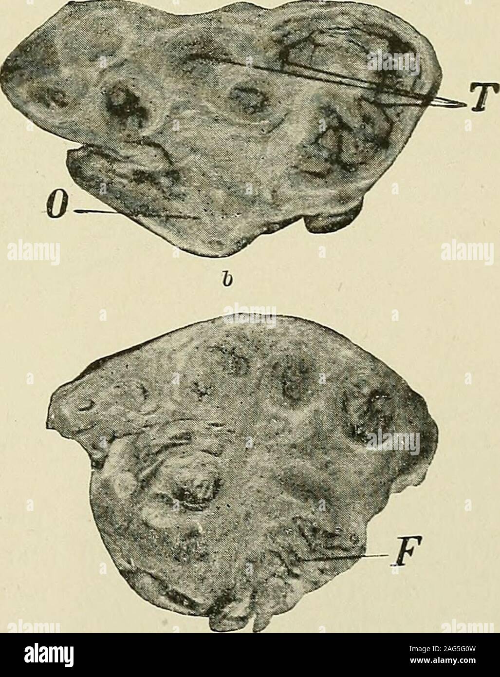 . Gynecological pathology; a manual of microscopic technique and ...