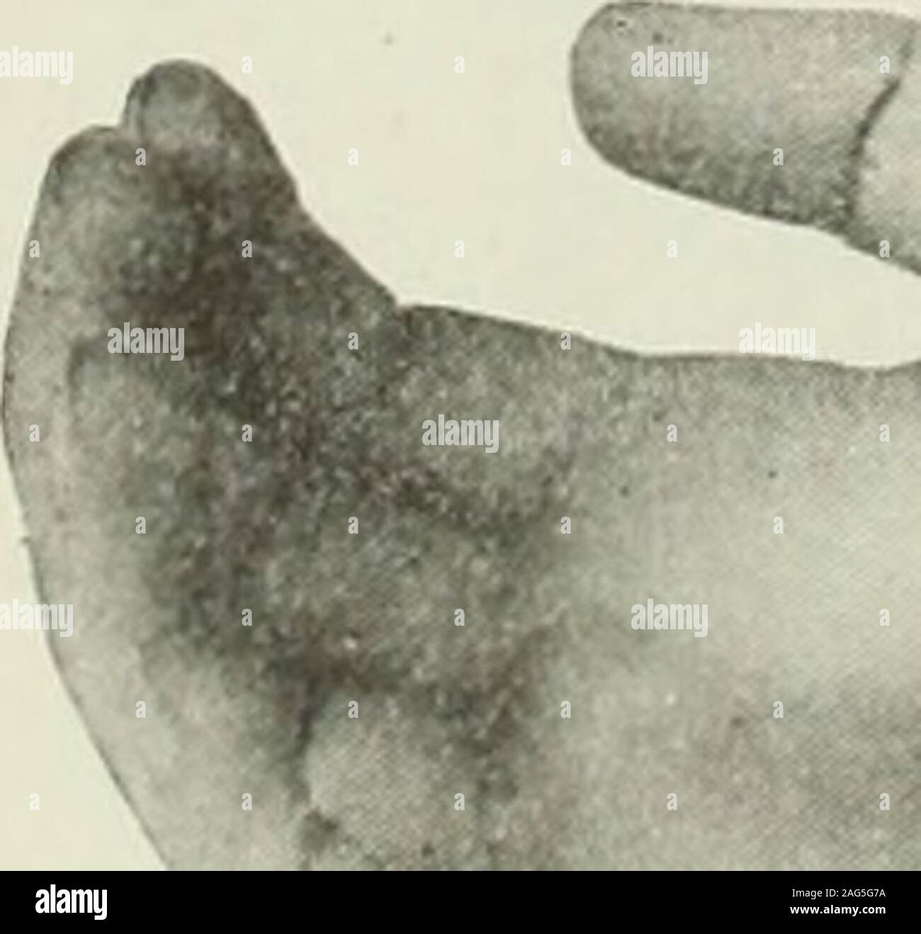 Curved thumb hi-res stock photography and images - Alamy