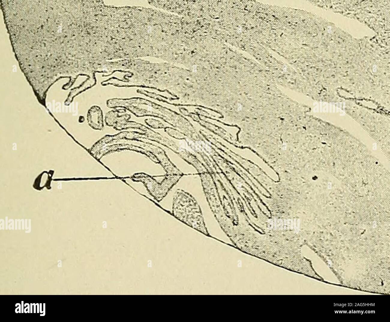 Fetal membrane hi-res stock photography and images - Alamy