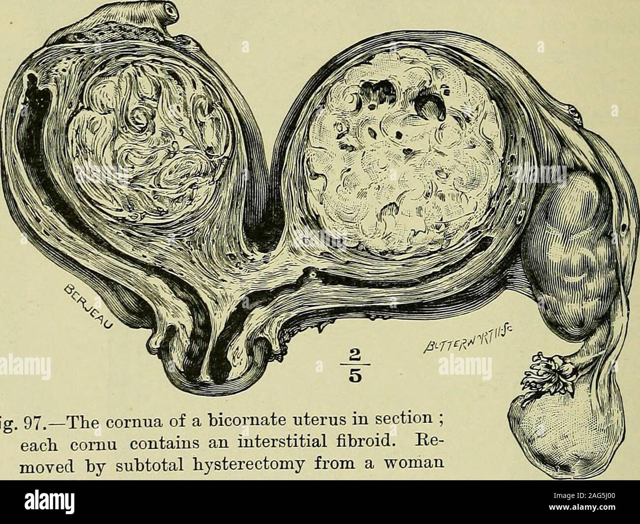 . Tumours, innocent and malignant; their clinical characters and ...