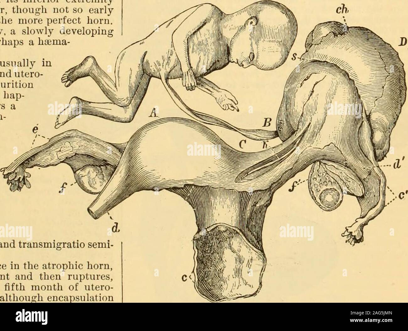 Sims position hi-res stock photography and images - Alamy