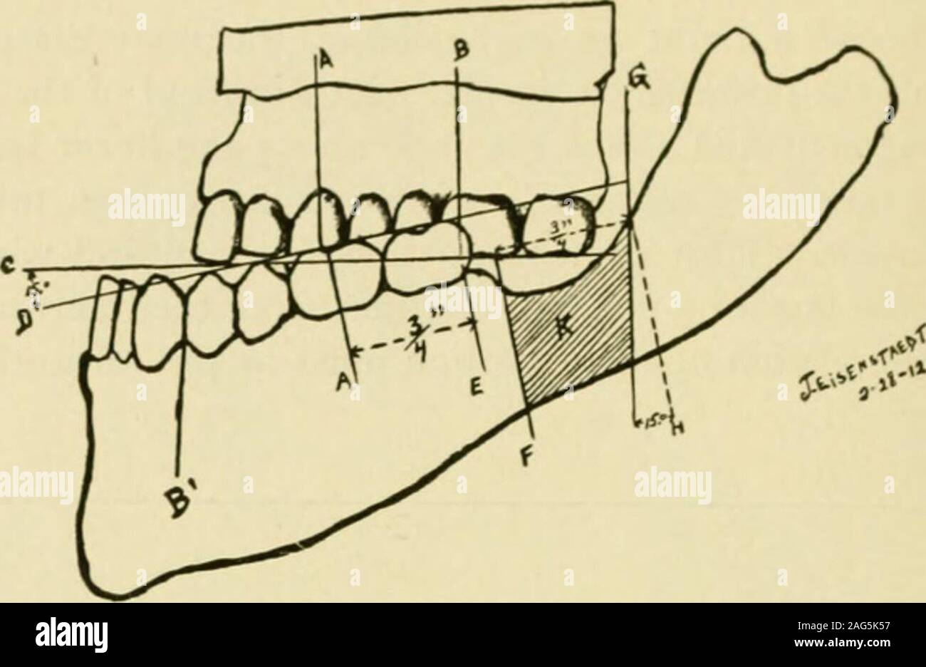 . Manual of operative surgery. e graft is necessary the bonebetween the ...