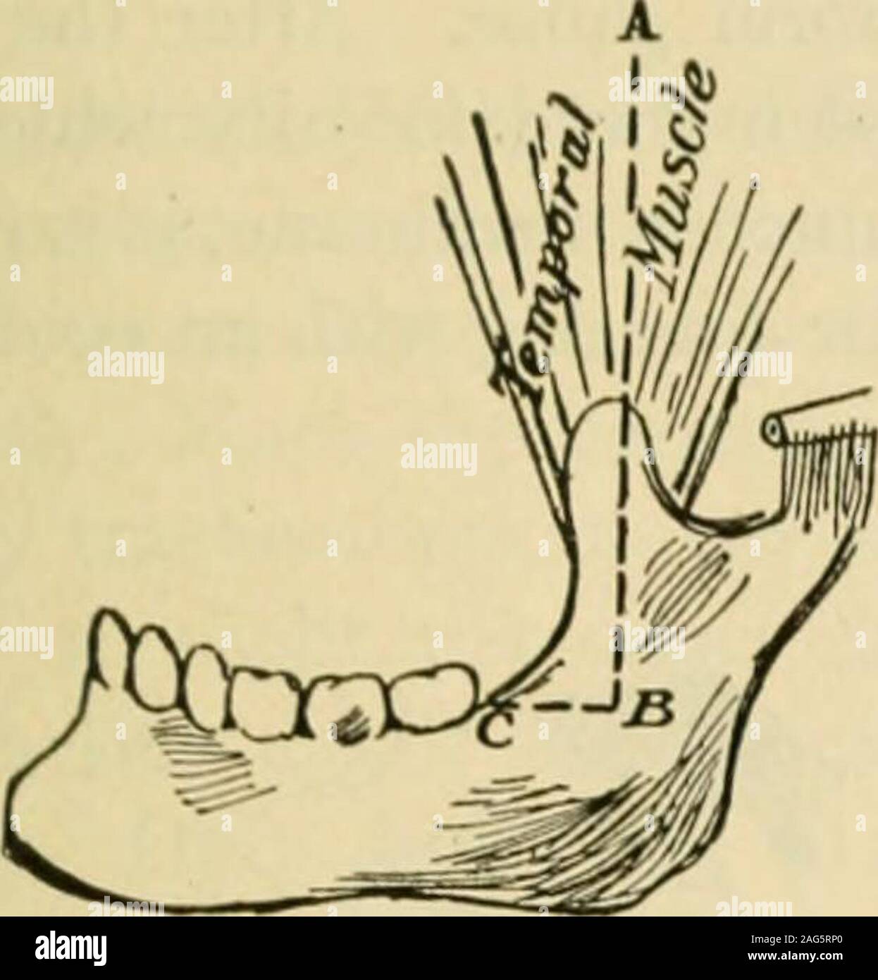 . Manual of operative surgery. 4, finger-breadthsfrom its anterior ...