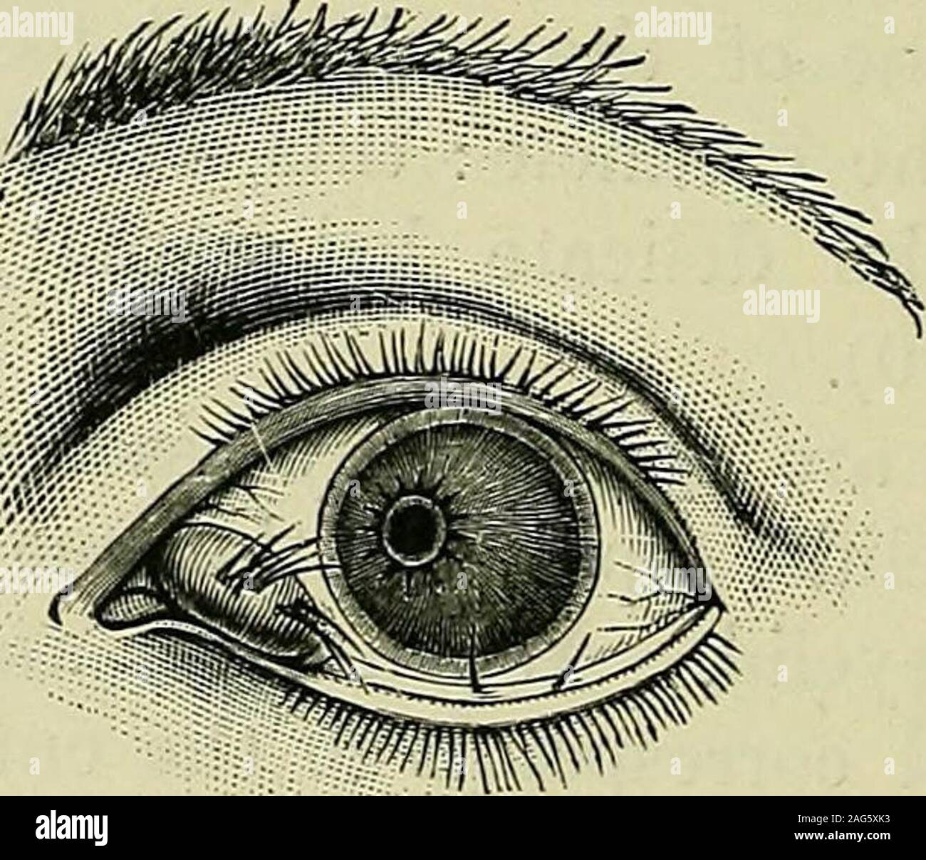 . Tumours, innocent and malignant; their clinical characters and ...