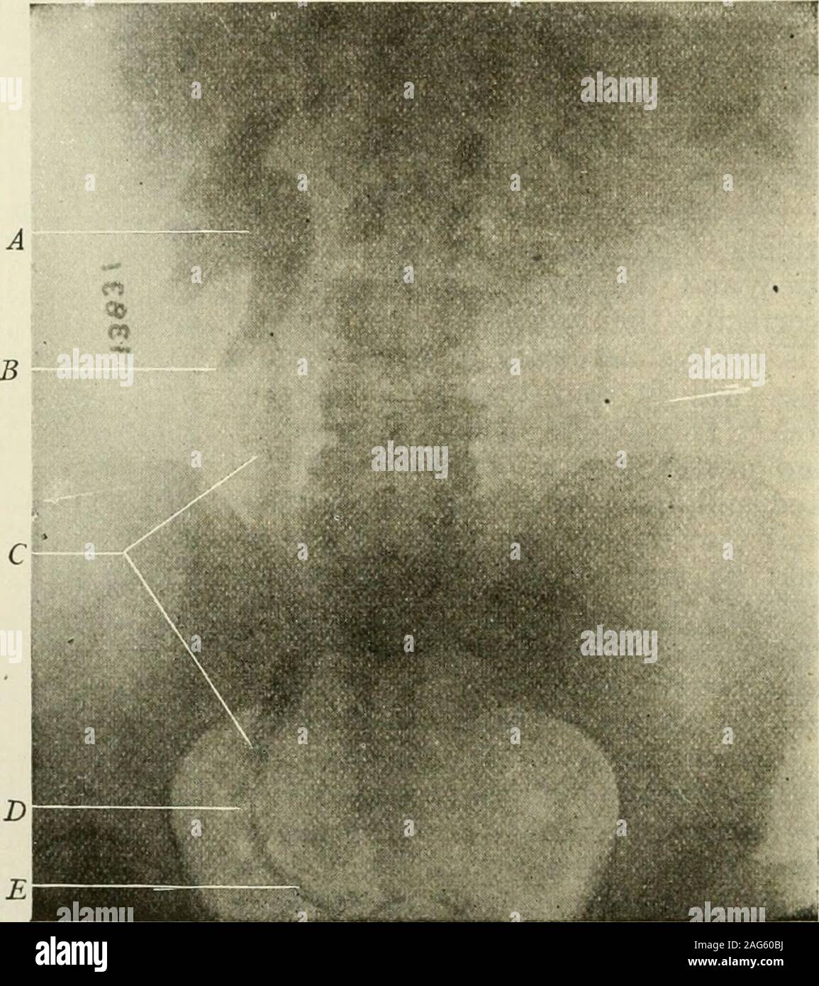 . Modern surgery, general and operative. juries of the Genito-urinary ...