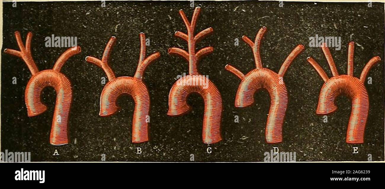 La carotide anatomie hi-res stock photography and images - Alamy
