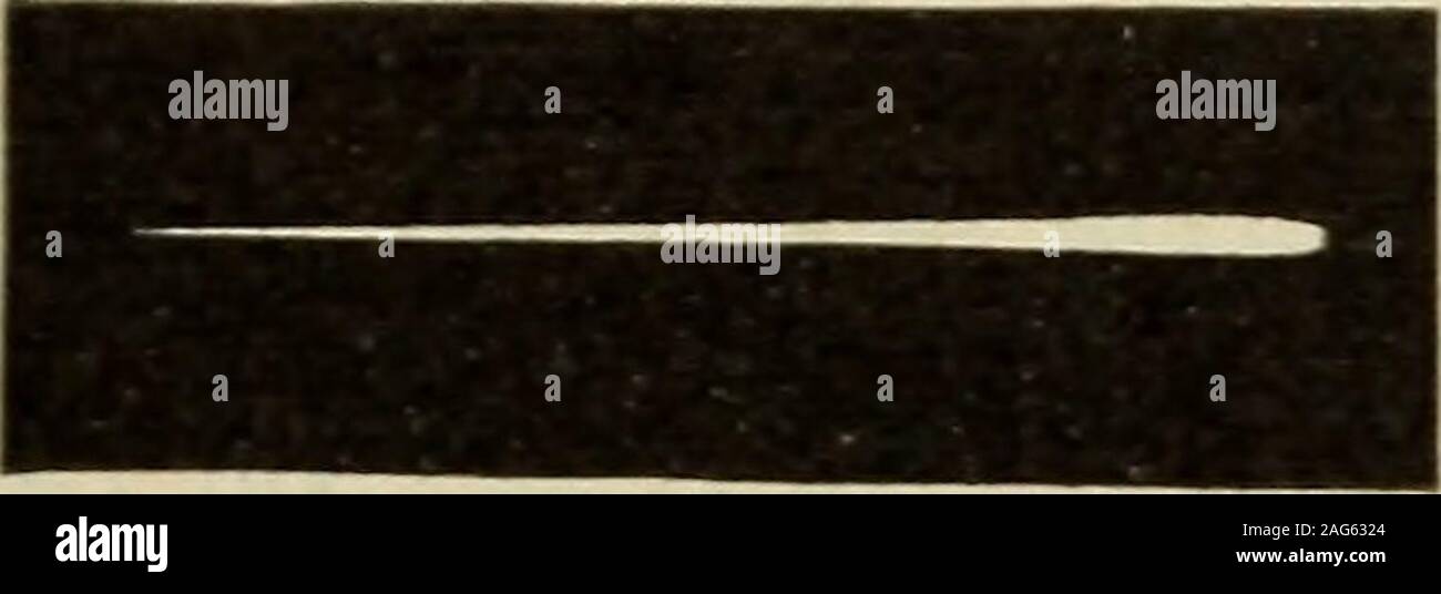 Alveolar abscess hi-res stock photography and images - Alamy