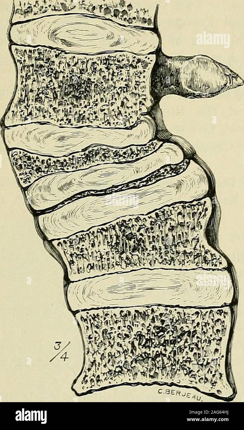 Malignant swelling hi-res stock photography and images - Alamy