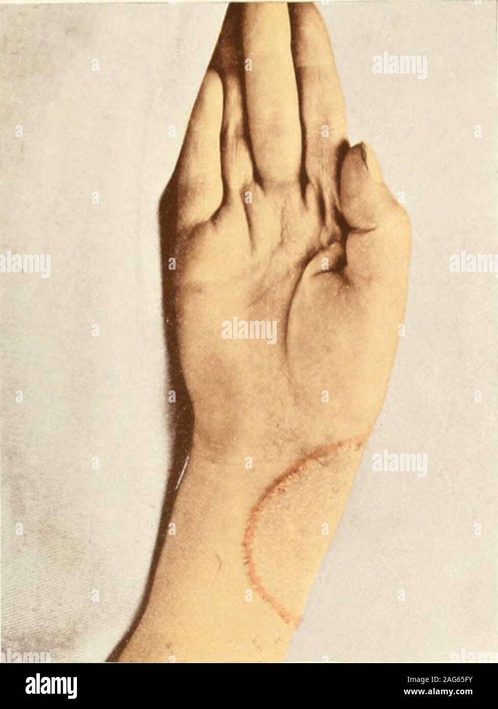 Atlas of skin diseases hi-res stock photography and images - Alamy