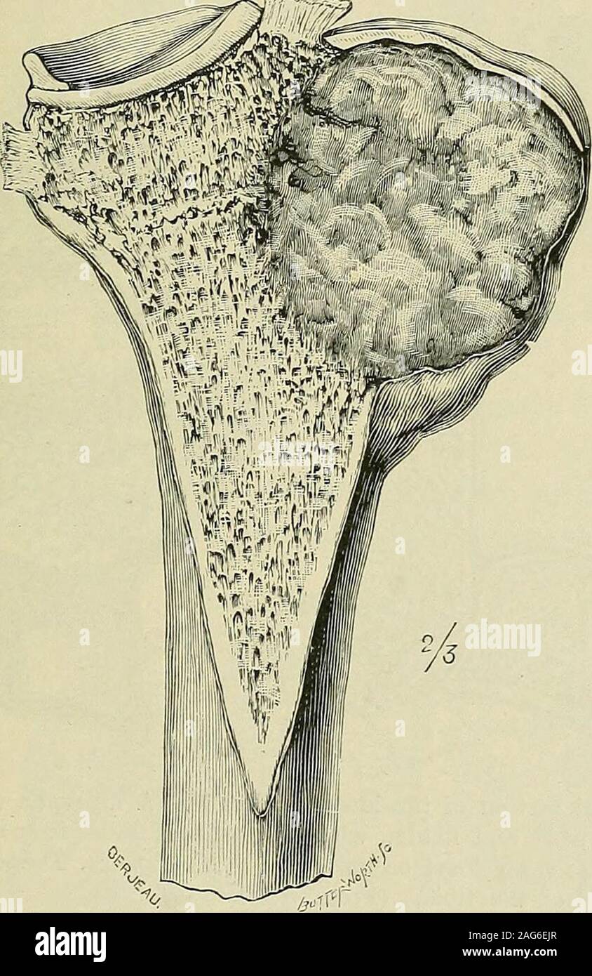 Longitudinal section long bone hi-res stock photography and images - Alamy