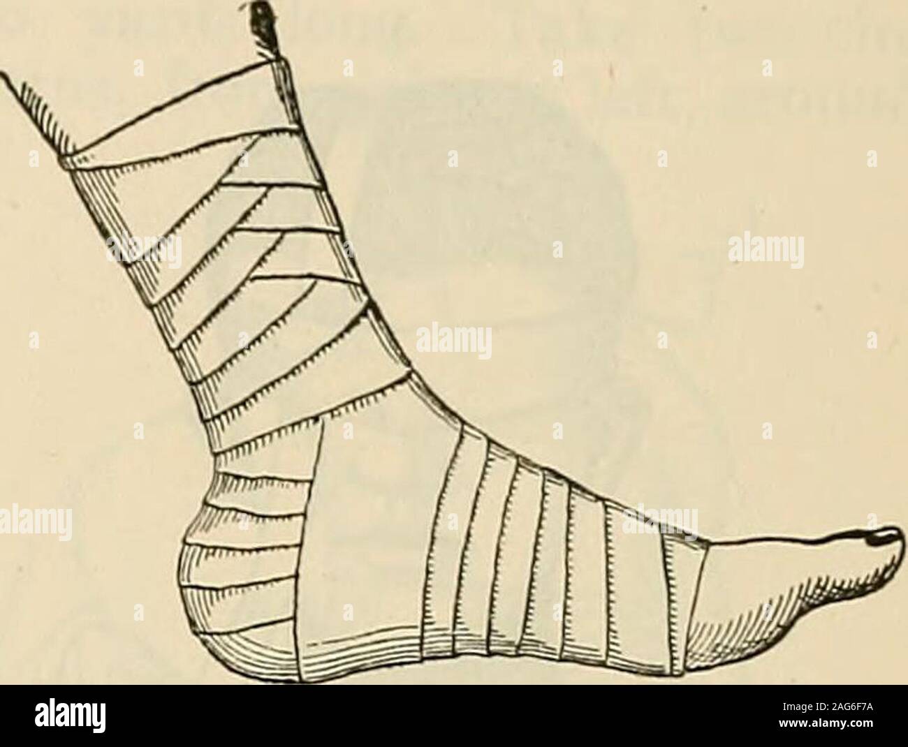 Dorsum of foot hi-res stock photography and images - Alamy