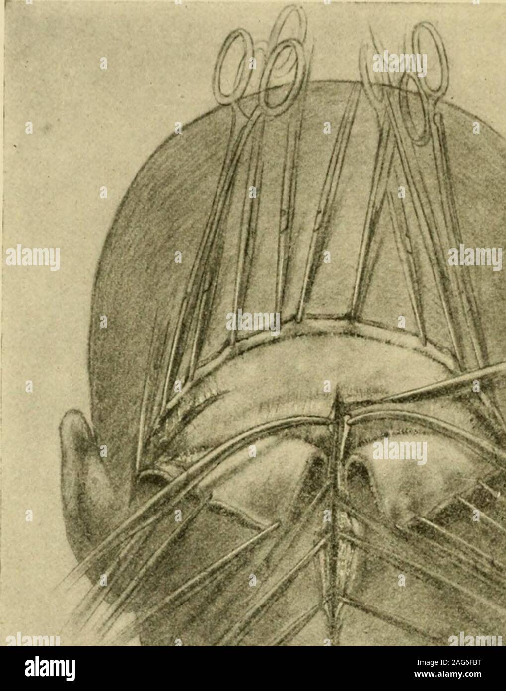 Acusticus hi-res stock photography and images - Alamy