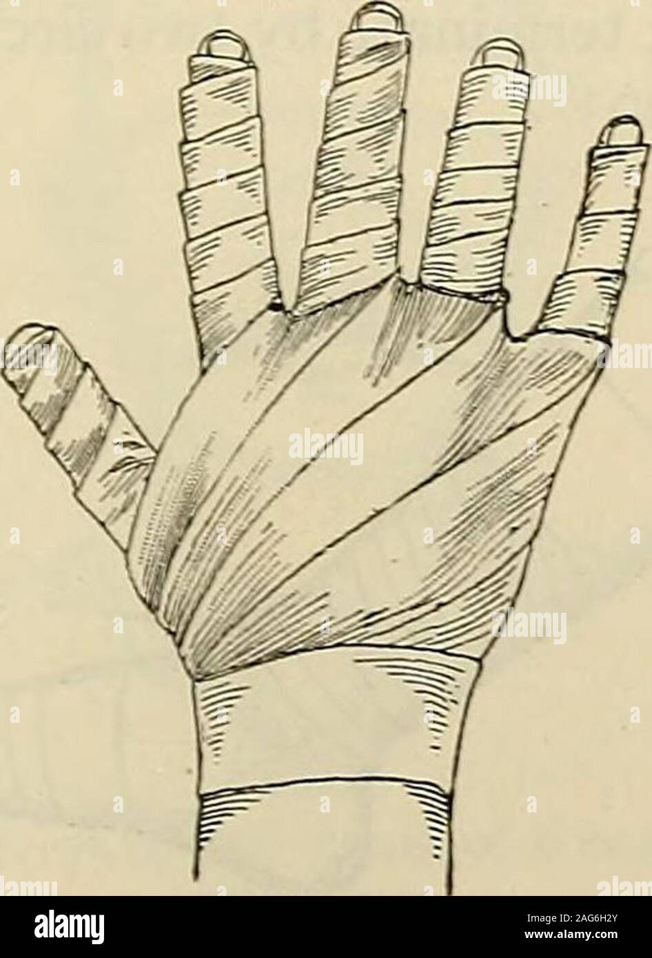 Spiral bandage hi-res stock photography and images - Alamy