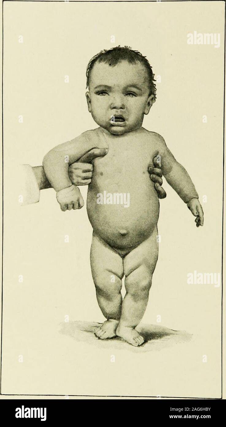 Cretin Aged Cretinism In Infants And Children Is Caused By, 47% OFF