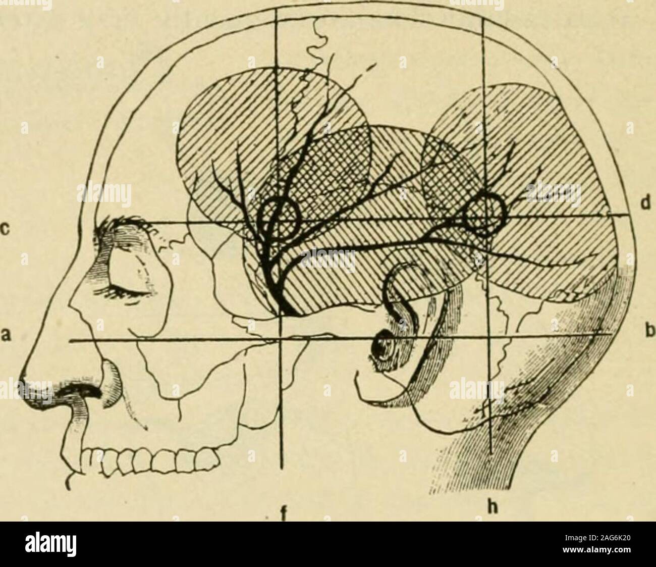 . Manual of operative surgery. t and Beckhave suggested trephining at a ...