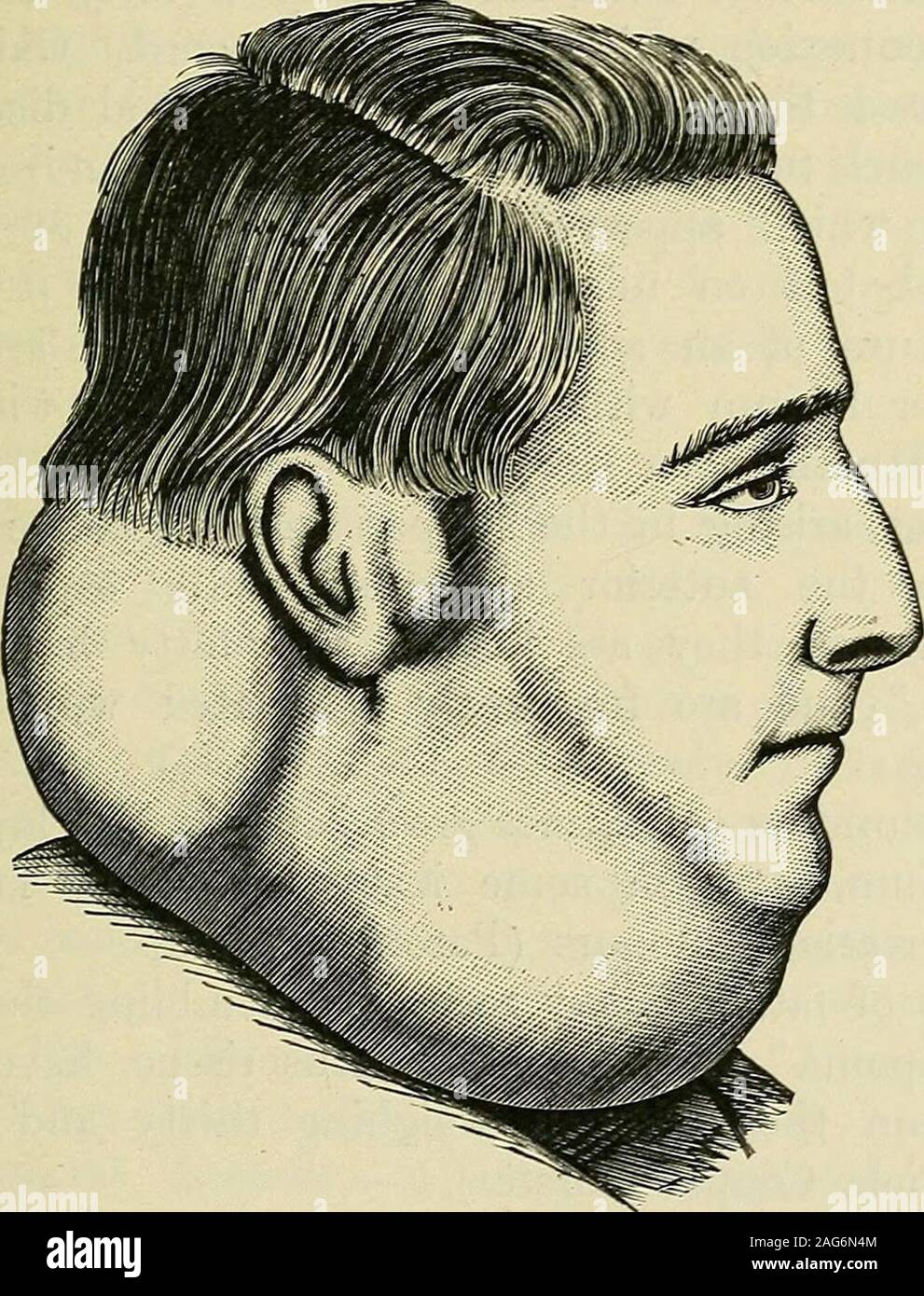 . Tumours, innocent and malignant; their clinical characters and ...