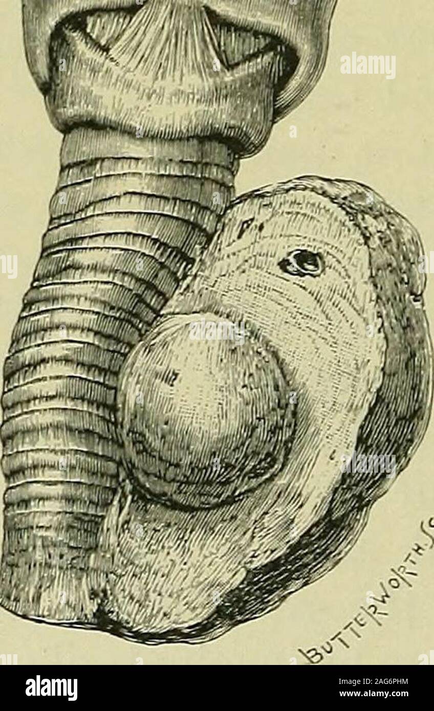 . Tumours, innocent and malignant; their clinical characters and ...