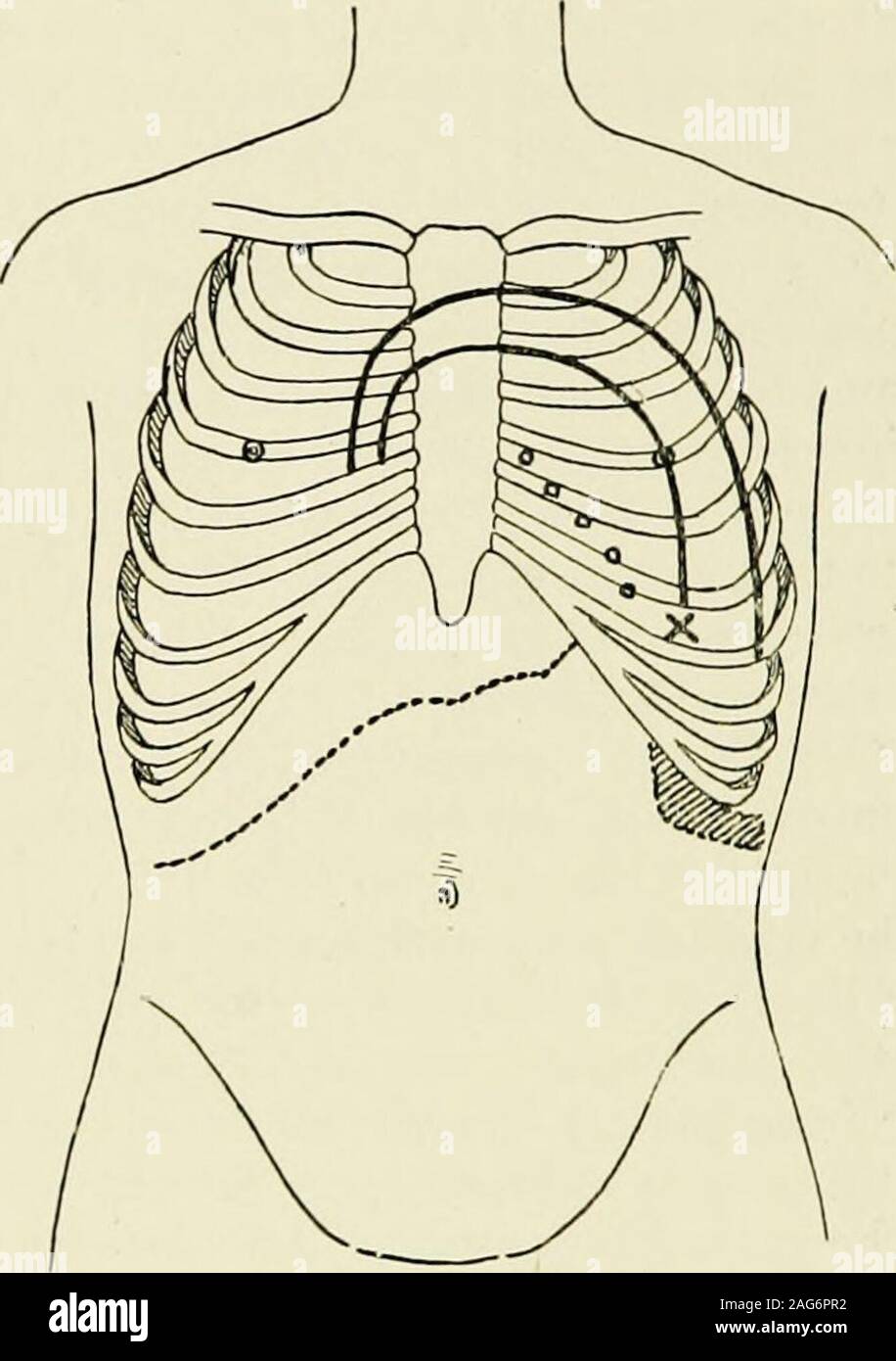 . The diseases of infancy and childhood : designed for the use of ...