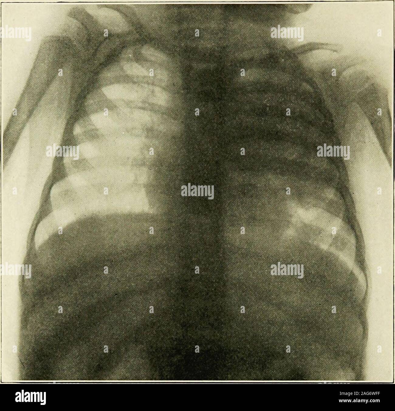 . The diseases of infancy and childhood : designed for the use of ...