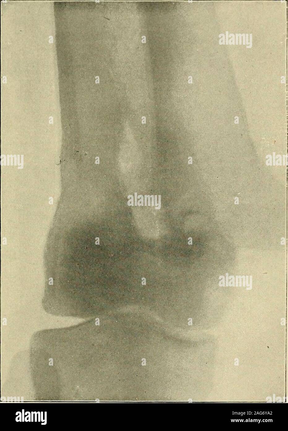 . The diseases of children : medical and surgical. Fig. 212 ...