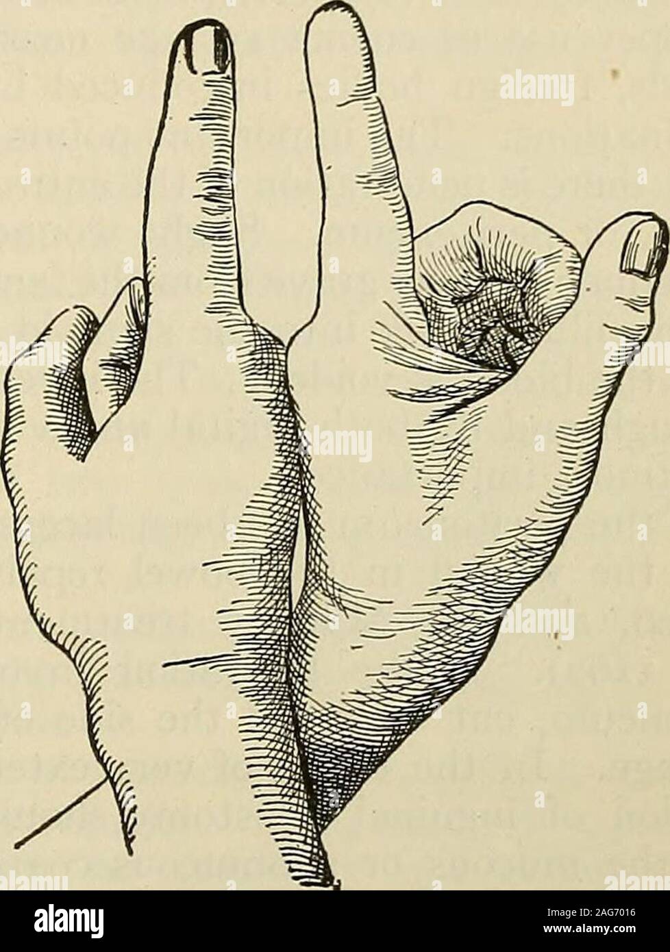 Proctoscopy hi-res stock photography and images - Alamy