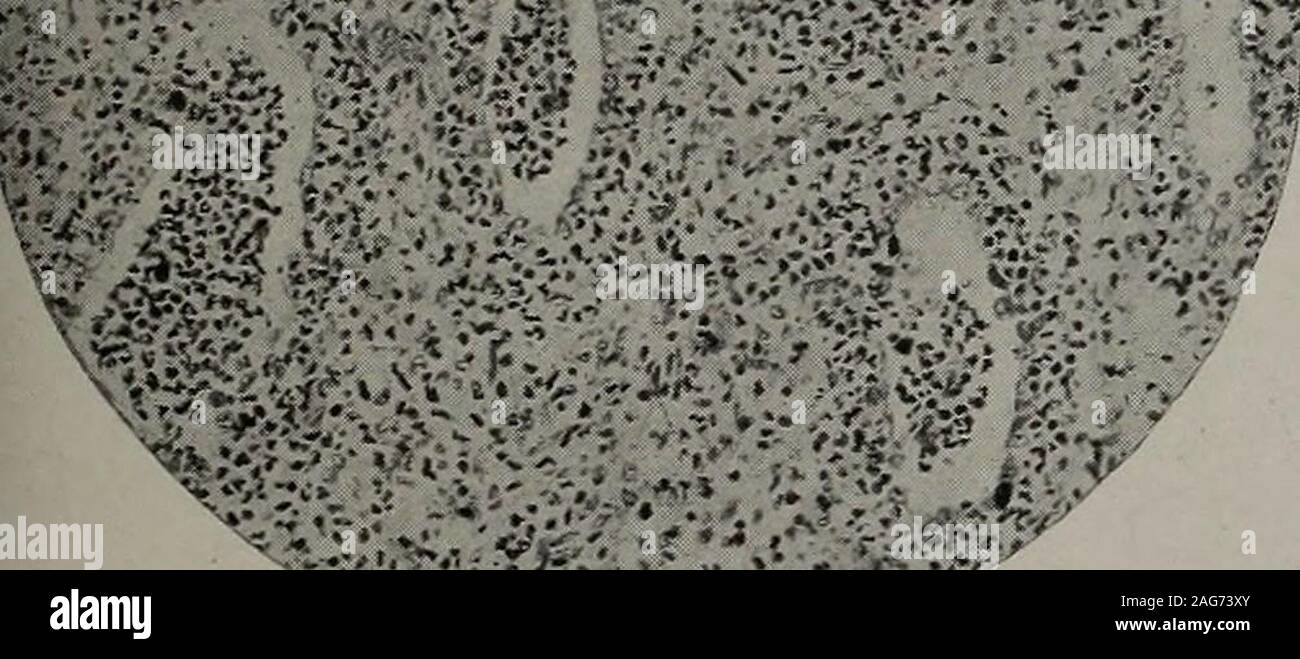 Intertubular tissue hi-res stock photography and images - Alamy