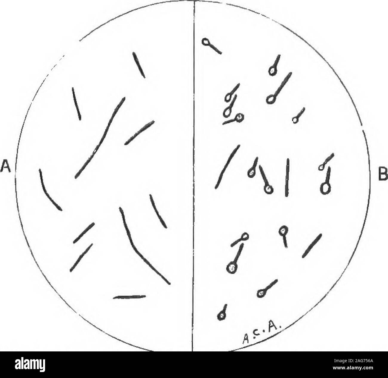 Tetanus bacillus Black and White Stock Photos & Images - Alamy