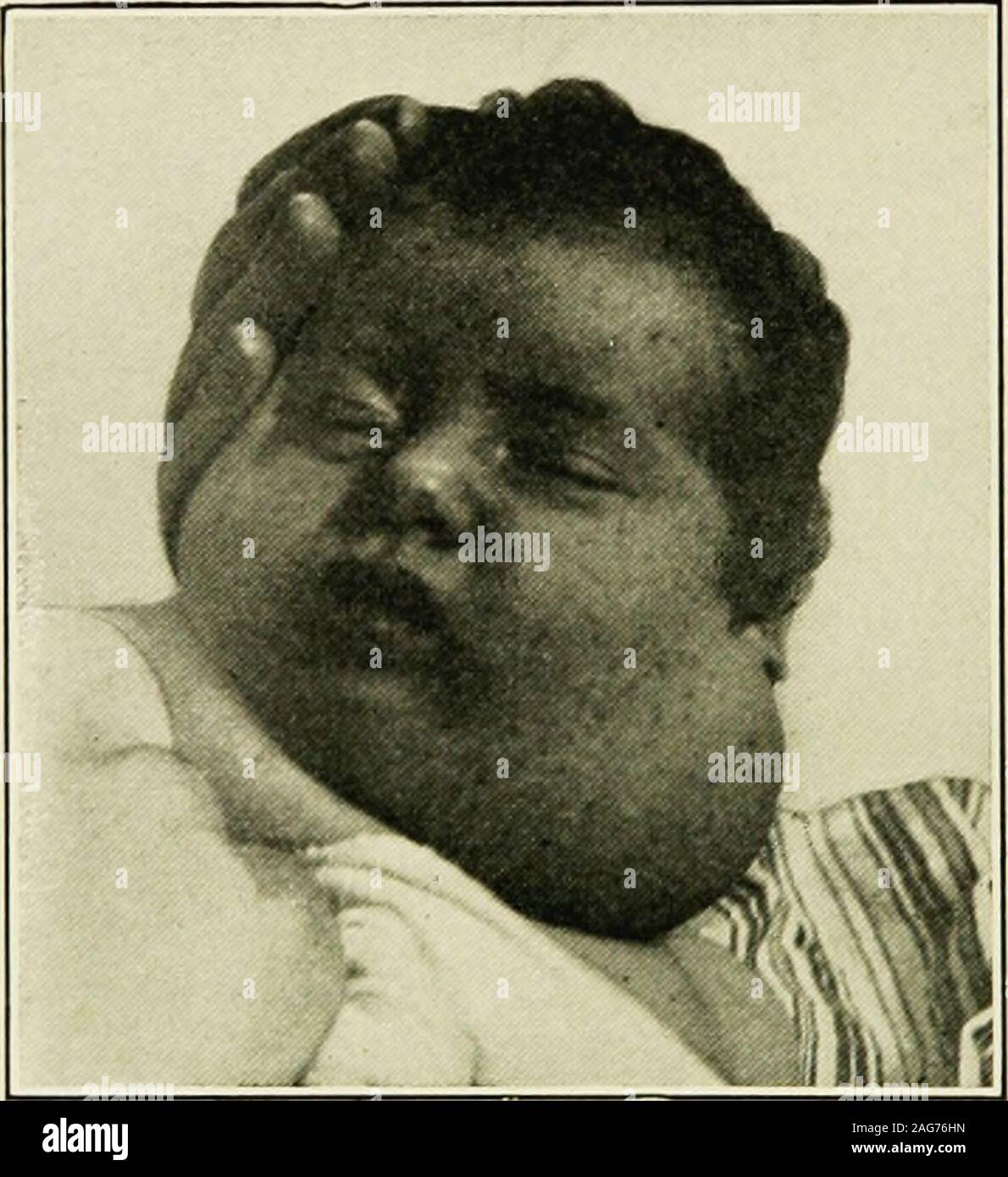 Uvula boy hi-res stock photography and images - Alamy
