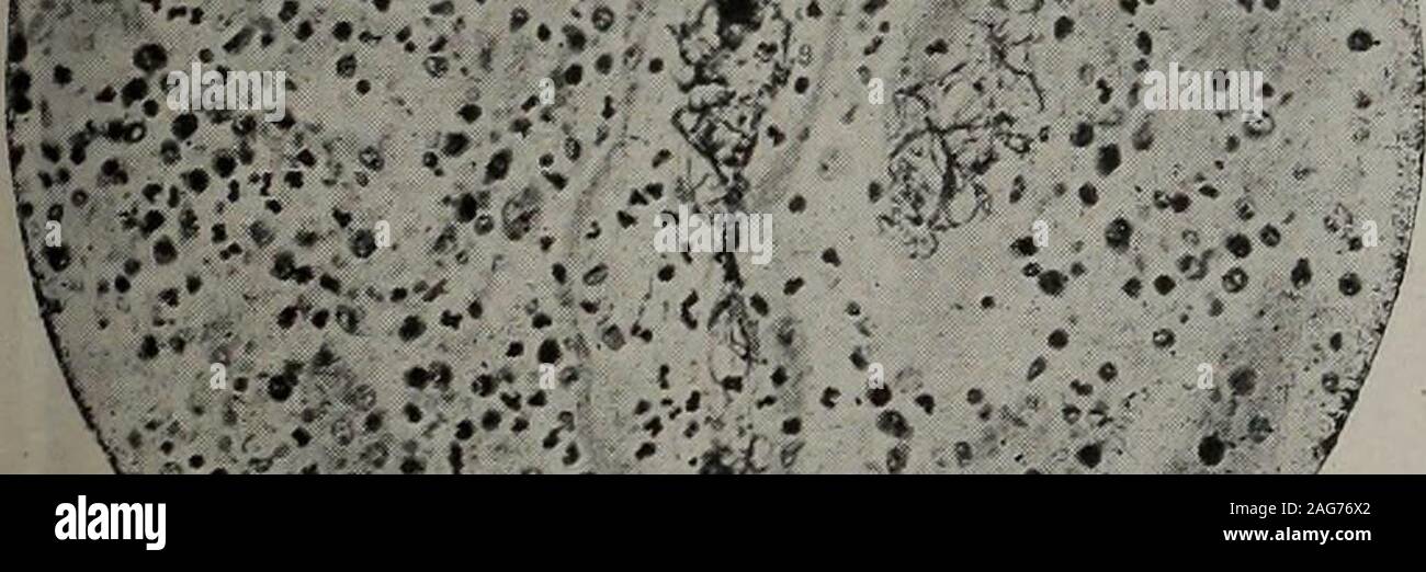 . Medical communications of the Massachusetts Medical Society. Kidney ...