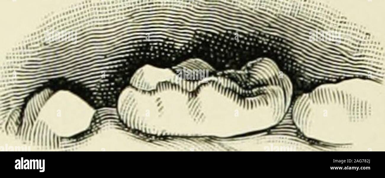 Boy take medicine in hi-res stock photography and images - Alamy