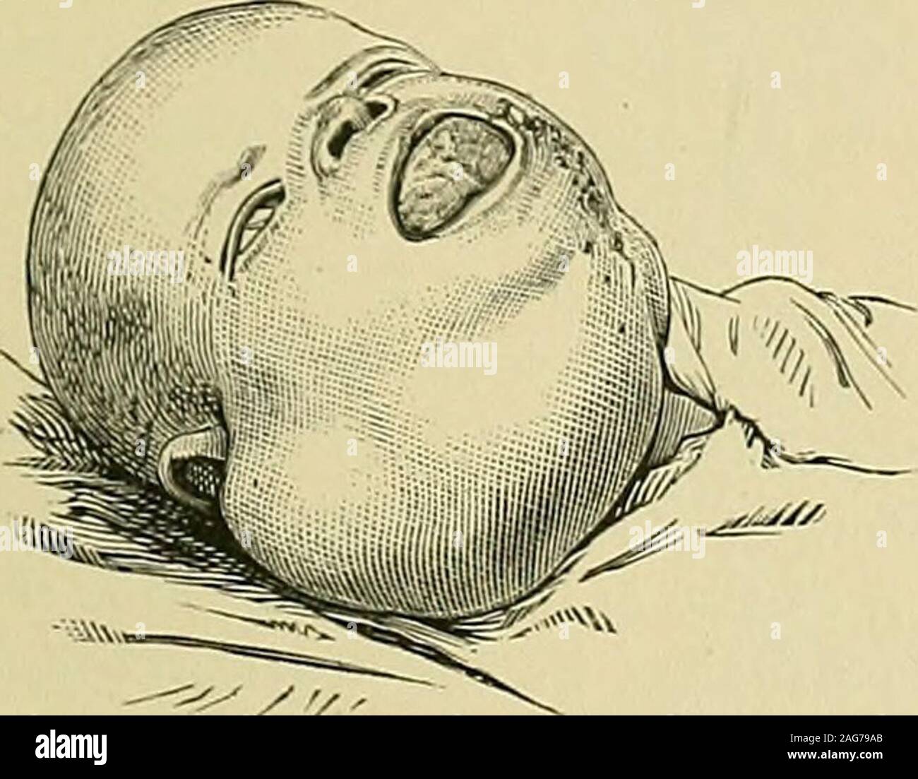 Osteomata hi-res stock photography and images - Alamy