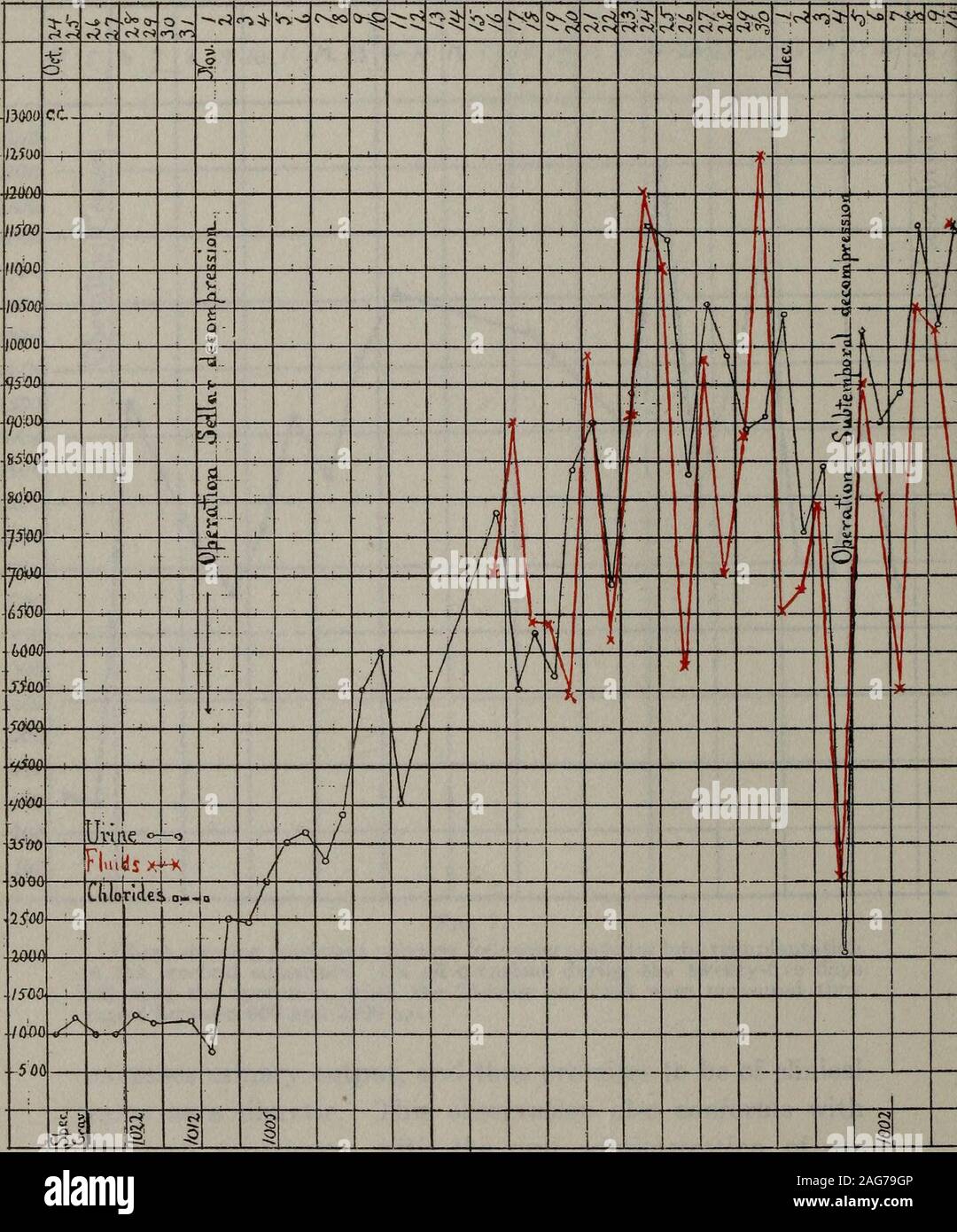 Subcortex hi-res stock photography and images - Alamy