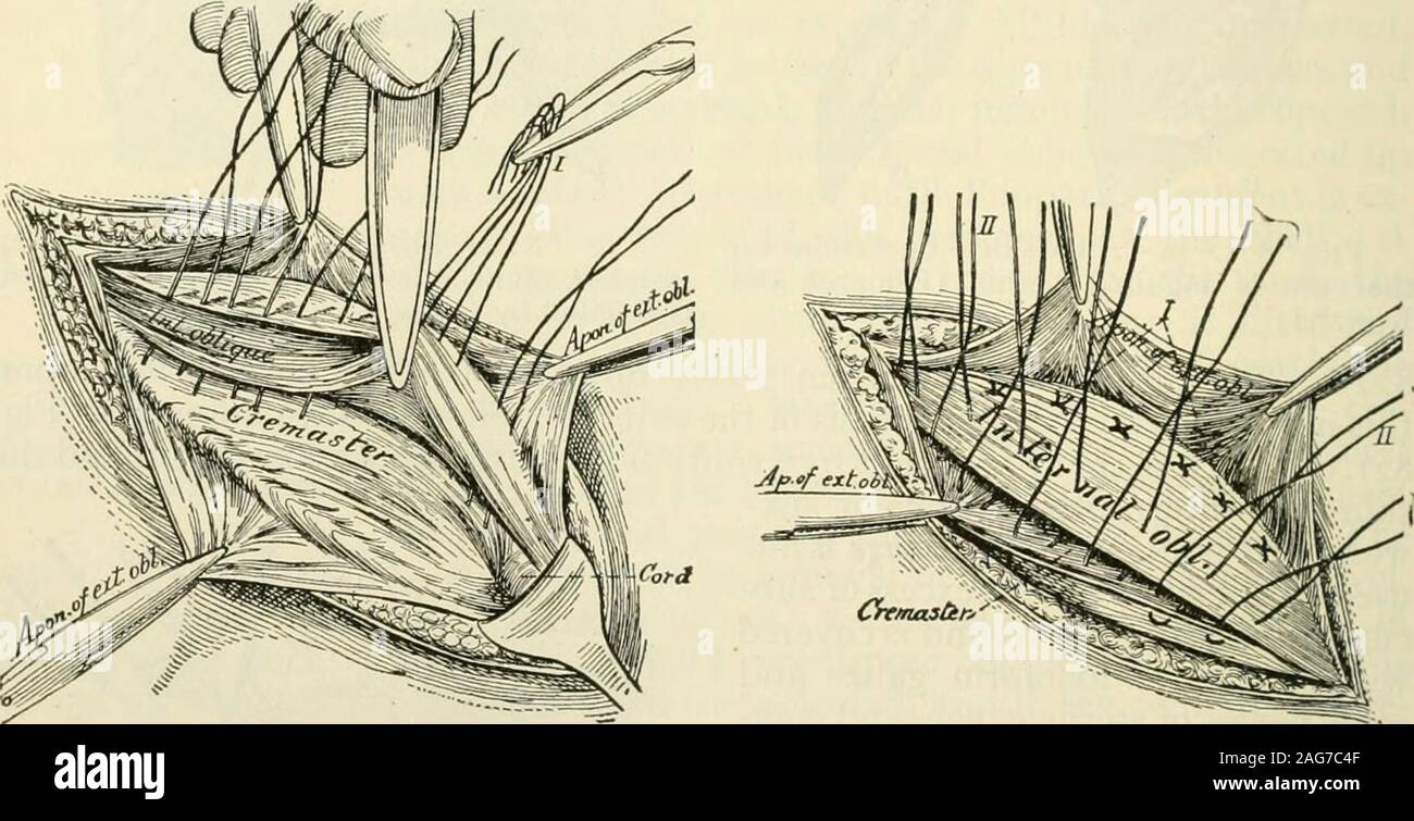 Cremaster muscle hi-res stock photography and images - Alamy