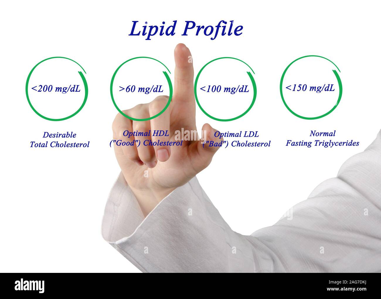 Lipid profile hi-res stock photography and images - Alamy