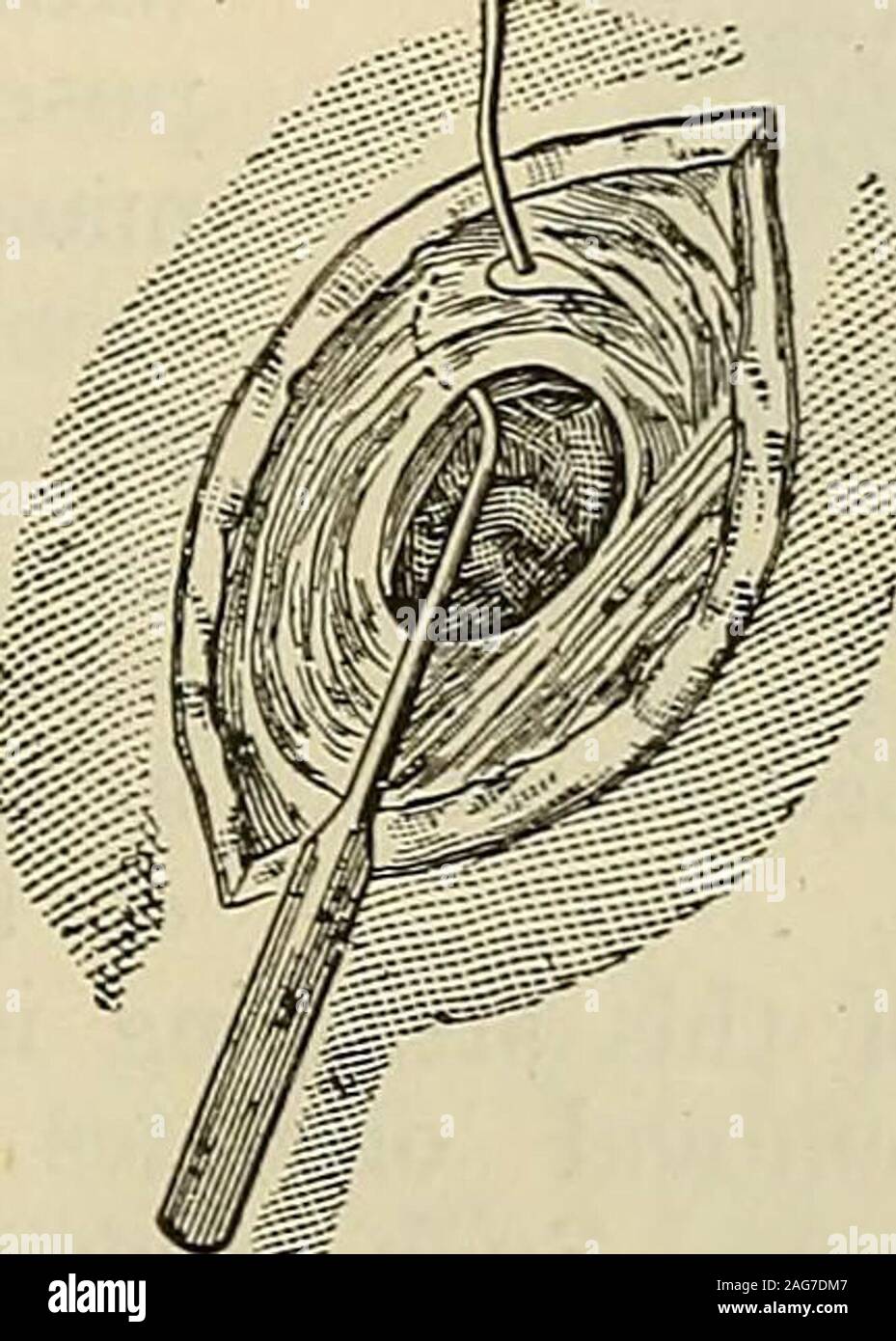 Modern surgery general operative hi-res stock photography and images ...