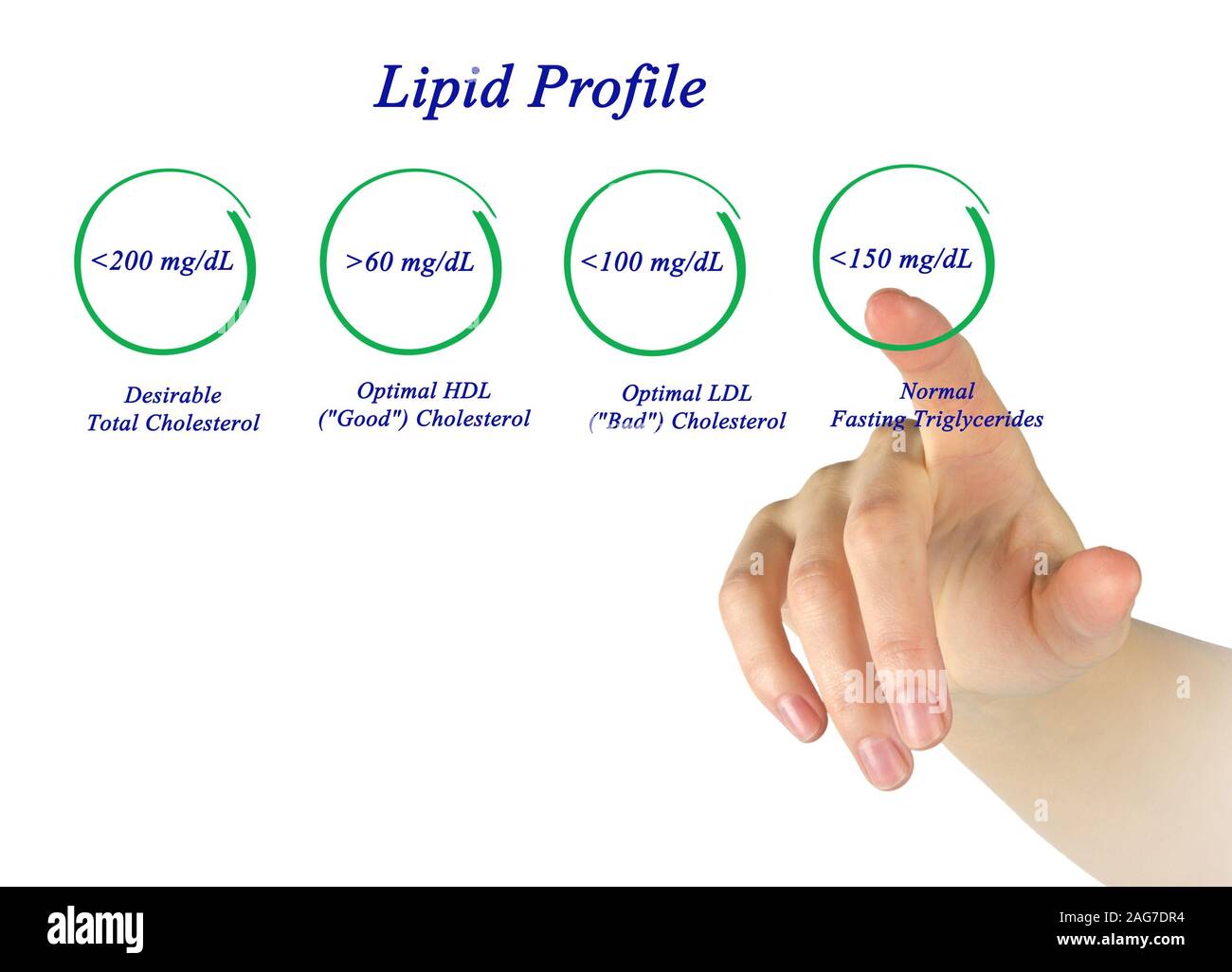 Lipid profile hi-res stock photography and images - Alamy