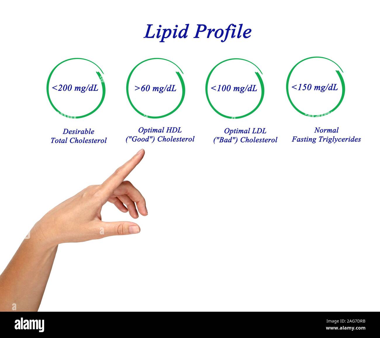 Lipid profile hi-res stock photography and images - Alamy