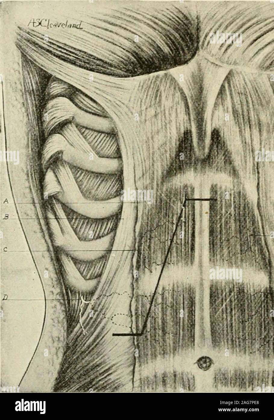 Mayo robsons hi-res stock photography and images - Alamy
