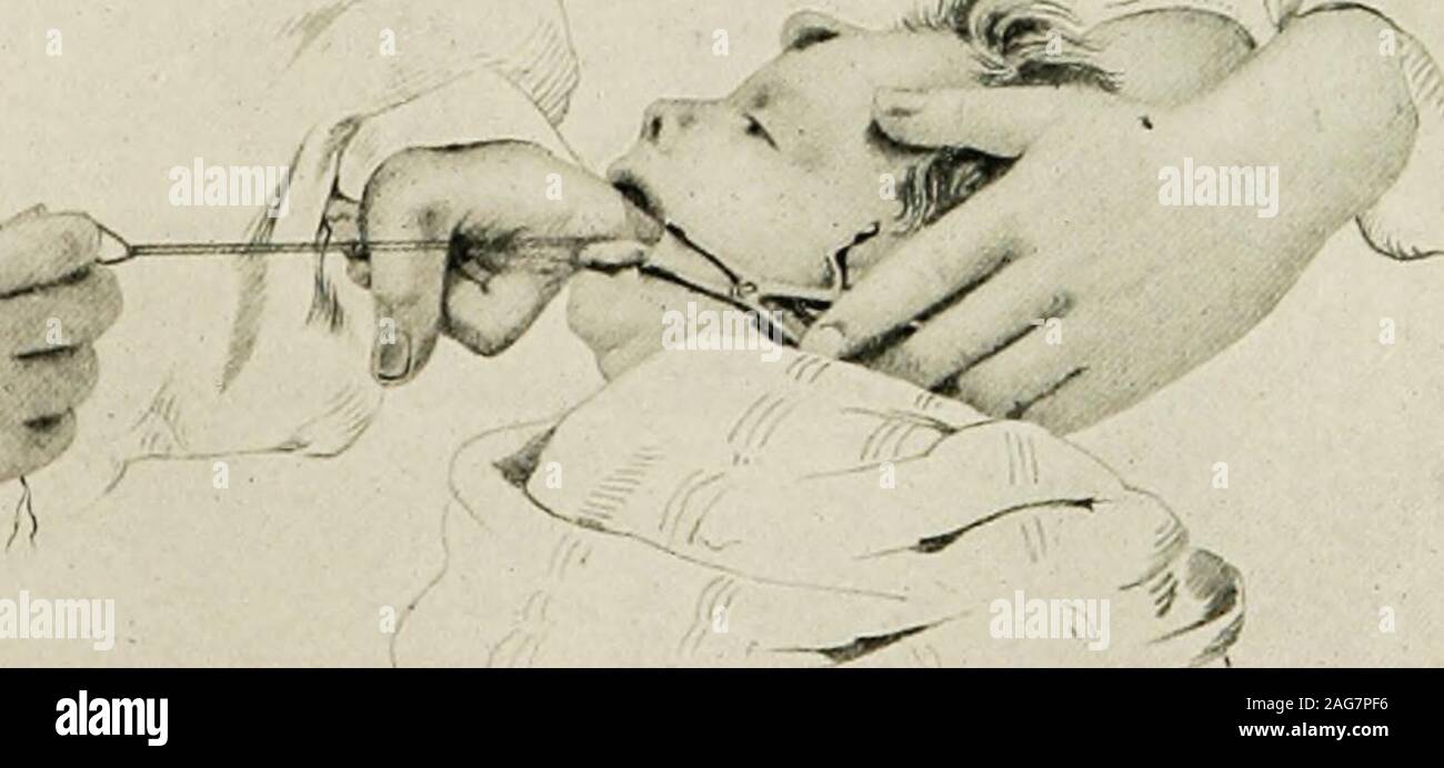 . The diseases of infancy and childhood : designed for the use of ...